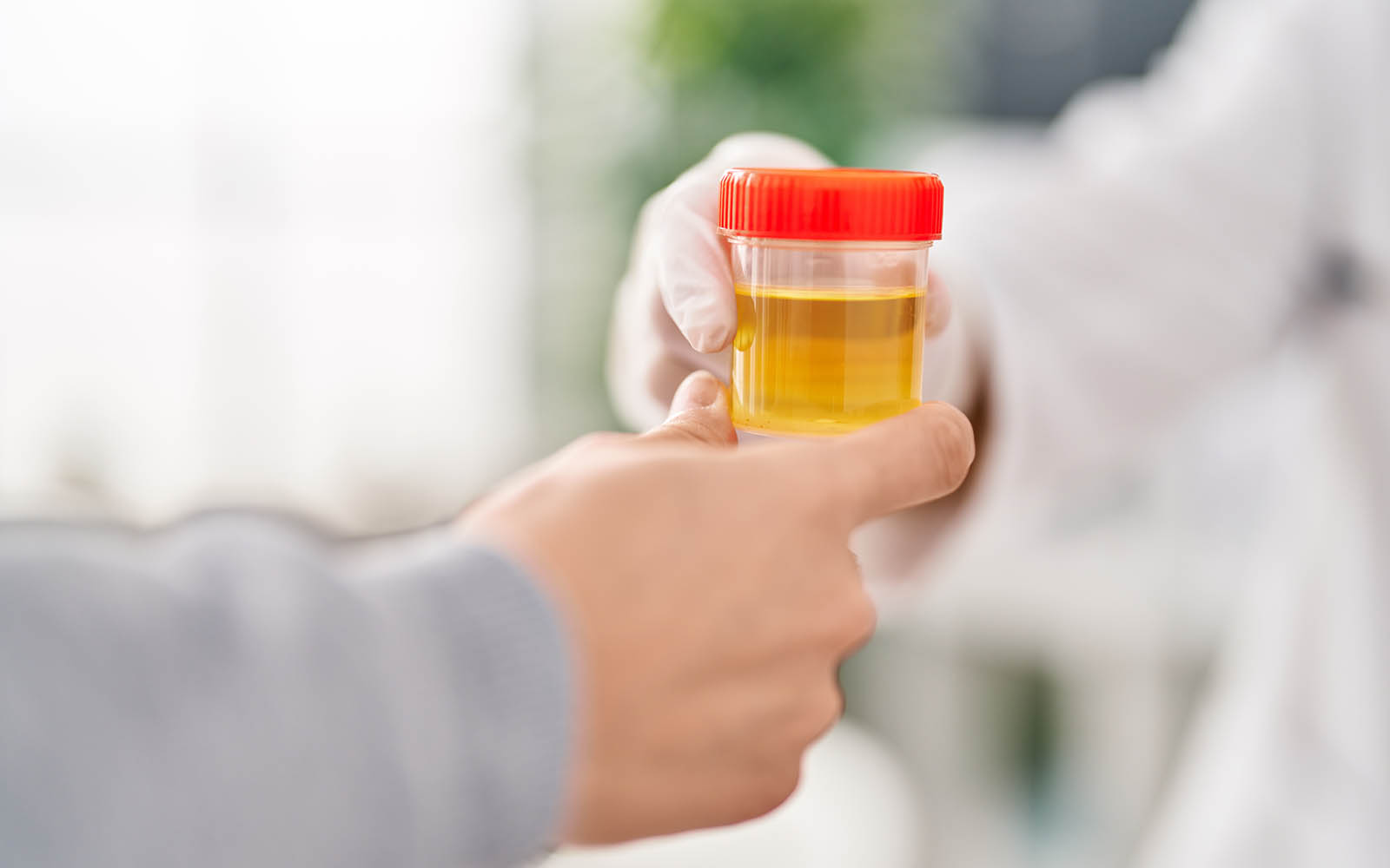 Nitrit im Urin - Laborwert und Bedeutung